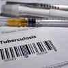 The global fight against Tuberculosis faces setback amid USAID cuts